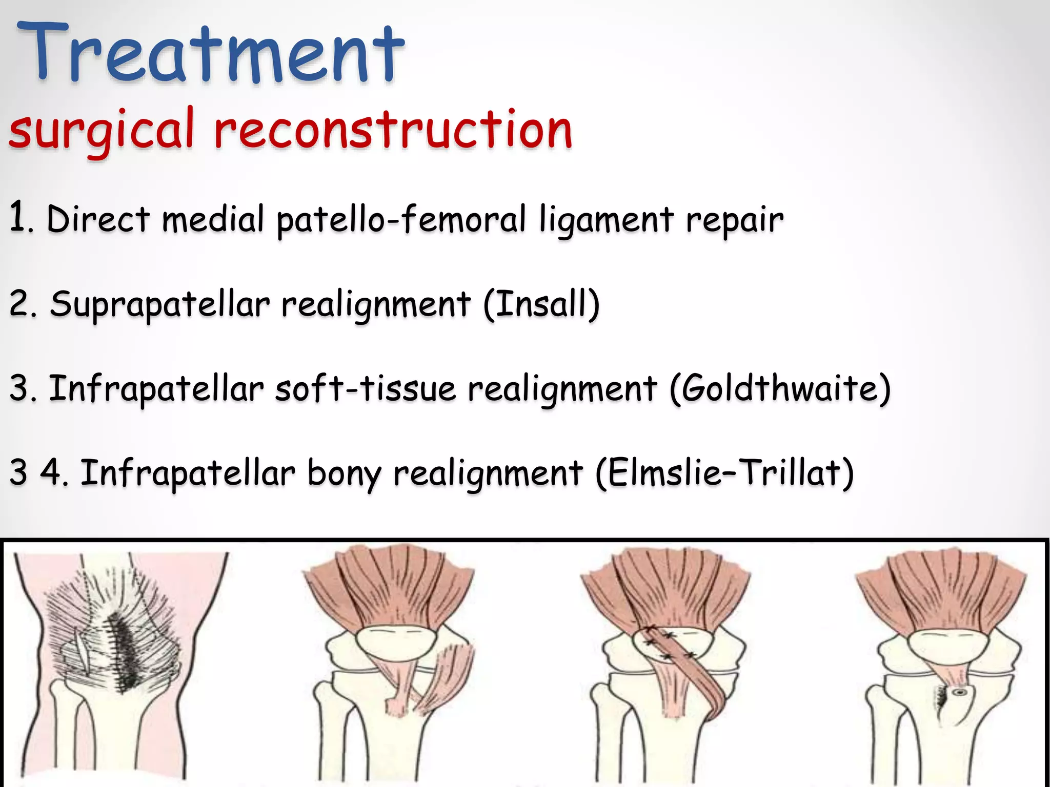 Patella and tibial plateau fractures | PPTX