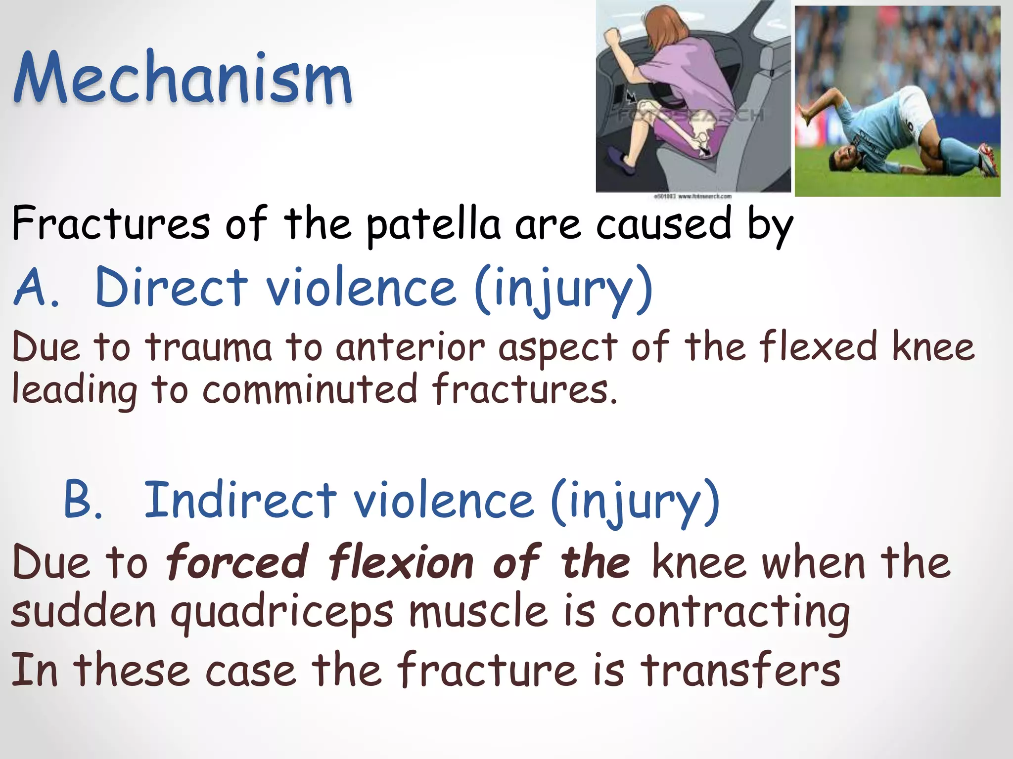 Patella and tibial plateau fractures | PPTX