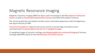 Patella fractures and extensor mechanism injuries | PPTX