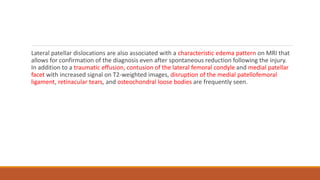 Patella fractures and extensor mechanism injuries | PPTX
