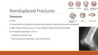 Patella fractures and extensor mechanism injuries | PPTX
