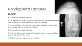 Patella fractures and extensor mechanism injuries | PPTX