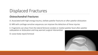Patella fractures and extensor mechanism injuries | PPTX