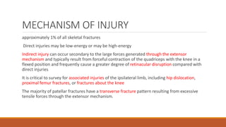Patella fractures and extensor mechanism injuries | PPTX