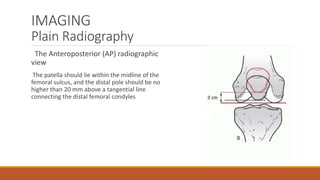 Patella fractures and extensor mechanism injuries | PPTX