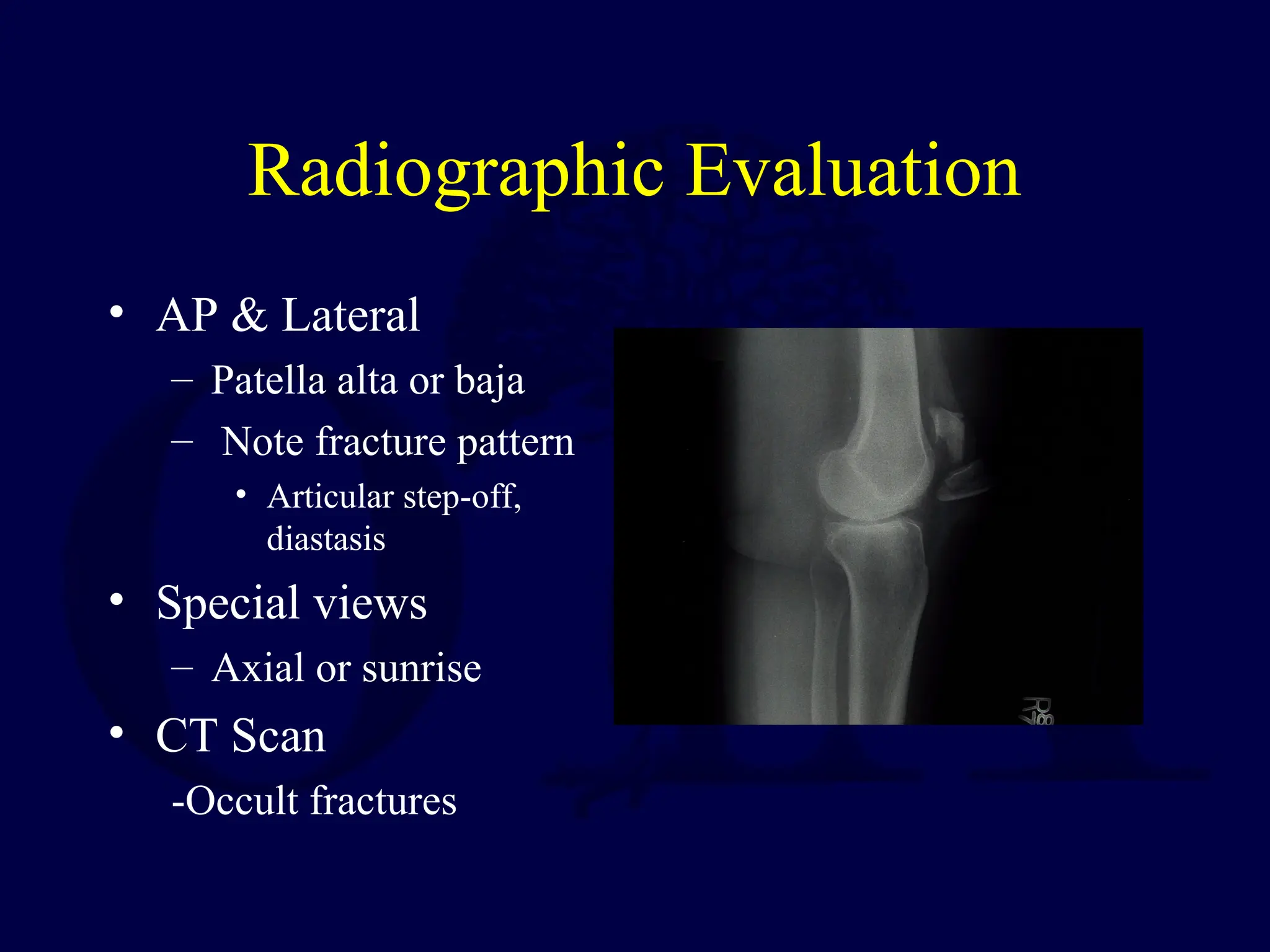 Patella Fractures & Extensor Mechanism Injuries.ppt