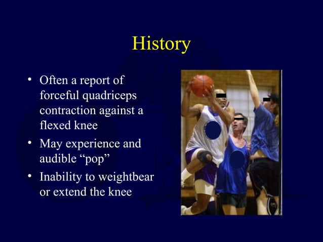 Patella Fractures & Extensor Mechanism Injuries.ppt