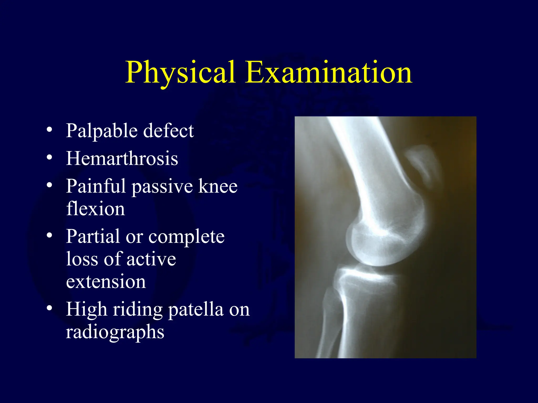 Patella Fractures & Extensor Mechanism Injuries.ppt