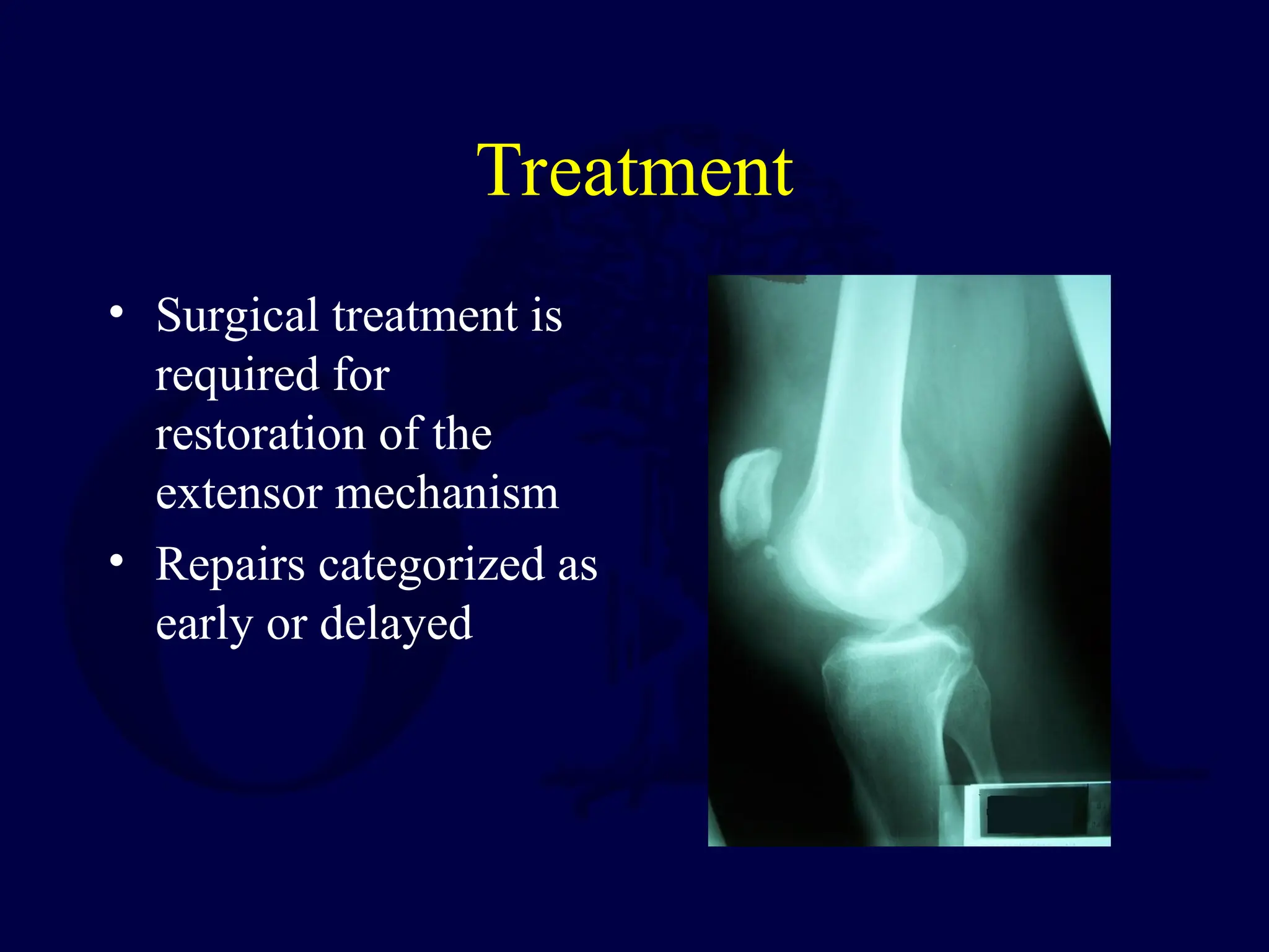 Patella Fractures & Extensor Mechanism Injuries.ppt