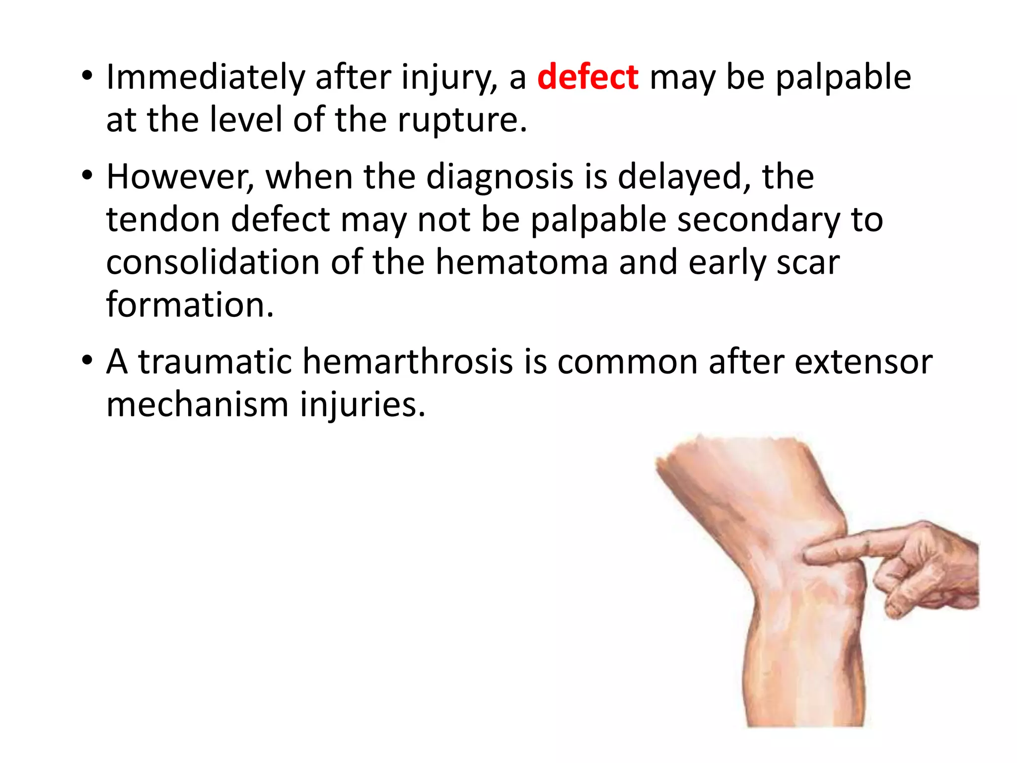 Patellar and quadriceps tendon rupture | PPTX