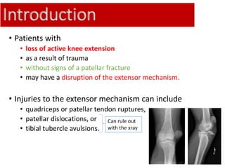 Patellar and quadriceps tendon rupture | PPTX