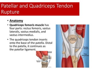 Patellar and quadriceps tendon rupture | PPTX