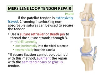 Patellar and quadriceps tendon rupture | PPTX