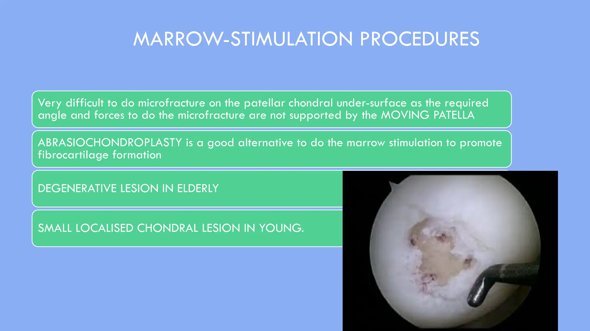 Patellar Cartilage lesions treatment in Jaipur | PDF