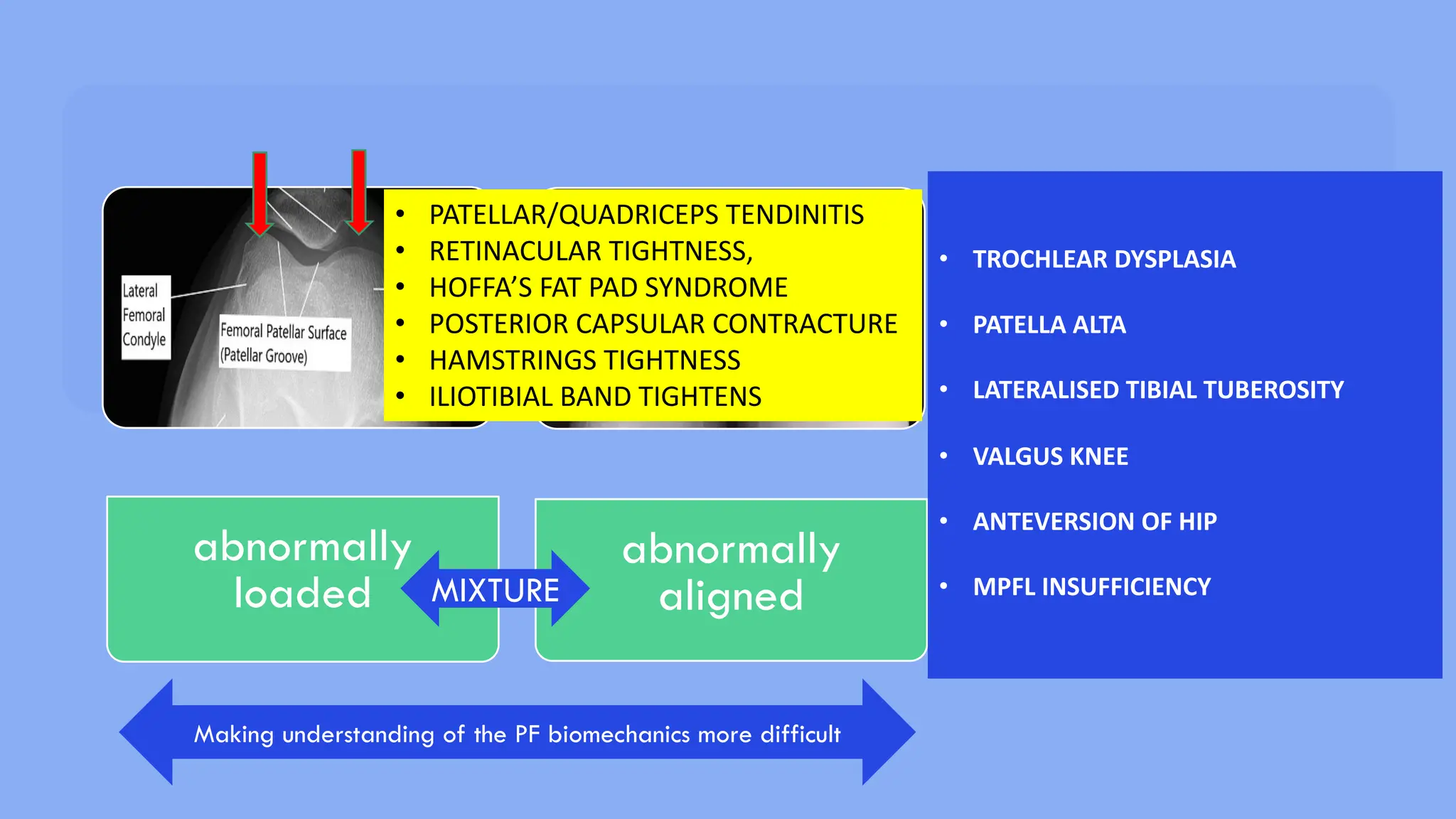 Patellar Cartilage lesions treatment in Jaipur | PDF