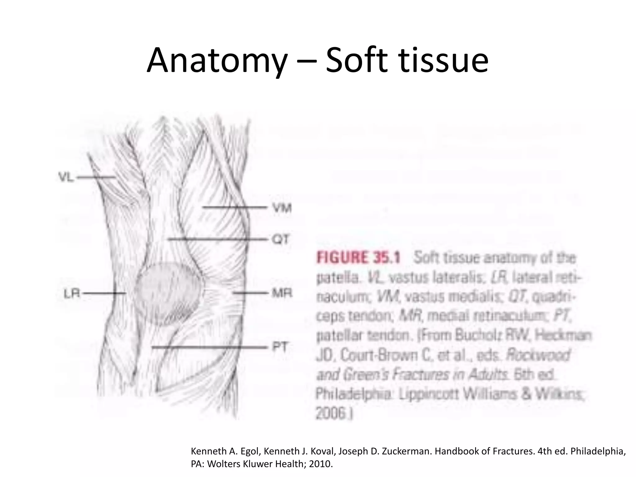 patellar fracture.pptx