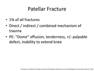 patellar fracture.pptx