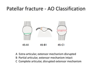 patellar fracture.pptx