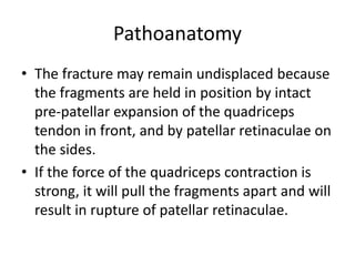 patellar fracture.ppt. . | PPT