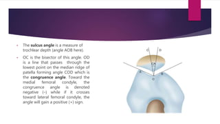 Recurrent Patellar instability | PPTX