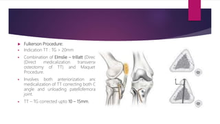 Recurrent Patellar instability | PPTX