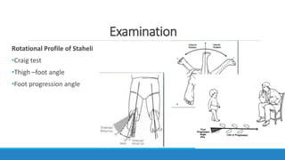 Patellar Instability | PPTX