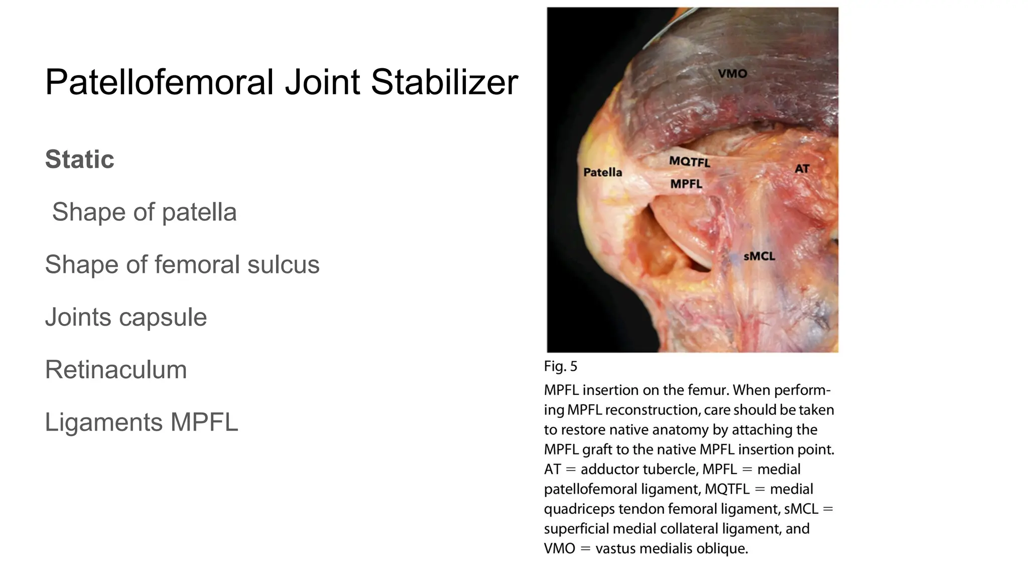 Patellar Instability: Diagnosis Management | PDF