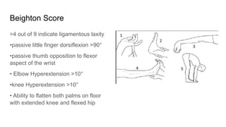 Patellar Instability: Diagnosis Management | PDF