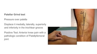 Patellar Instability: Diagnosis Management | PDF