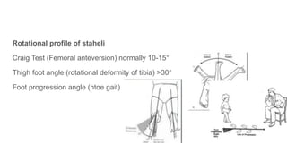 Patellar Instability: Diagnosis Management | PDF