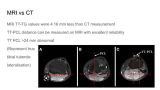 Patellar Instability: Diagnosis Management | PDF