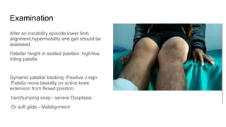 Patellar Instability: Diagnosis Management | PDF