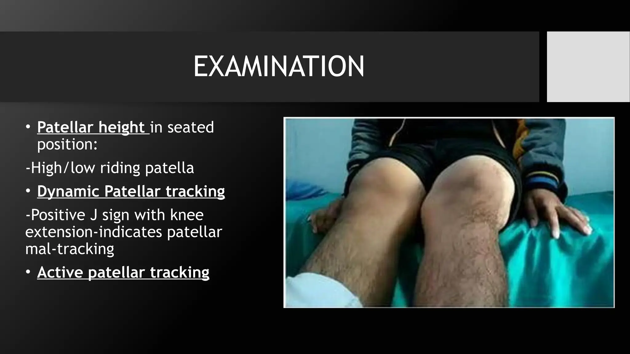 Patellar instability.pptx , introduction, anatomy | PPTX