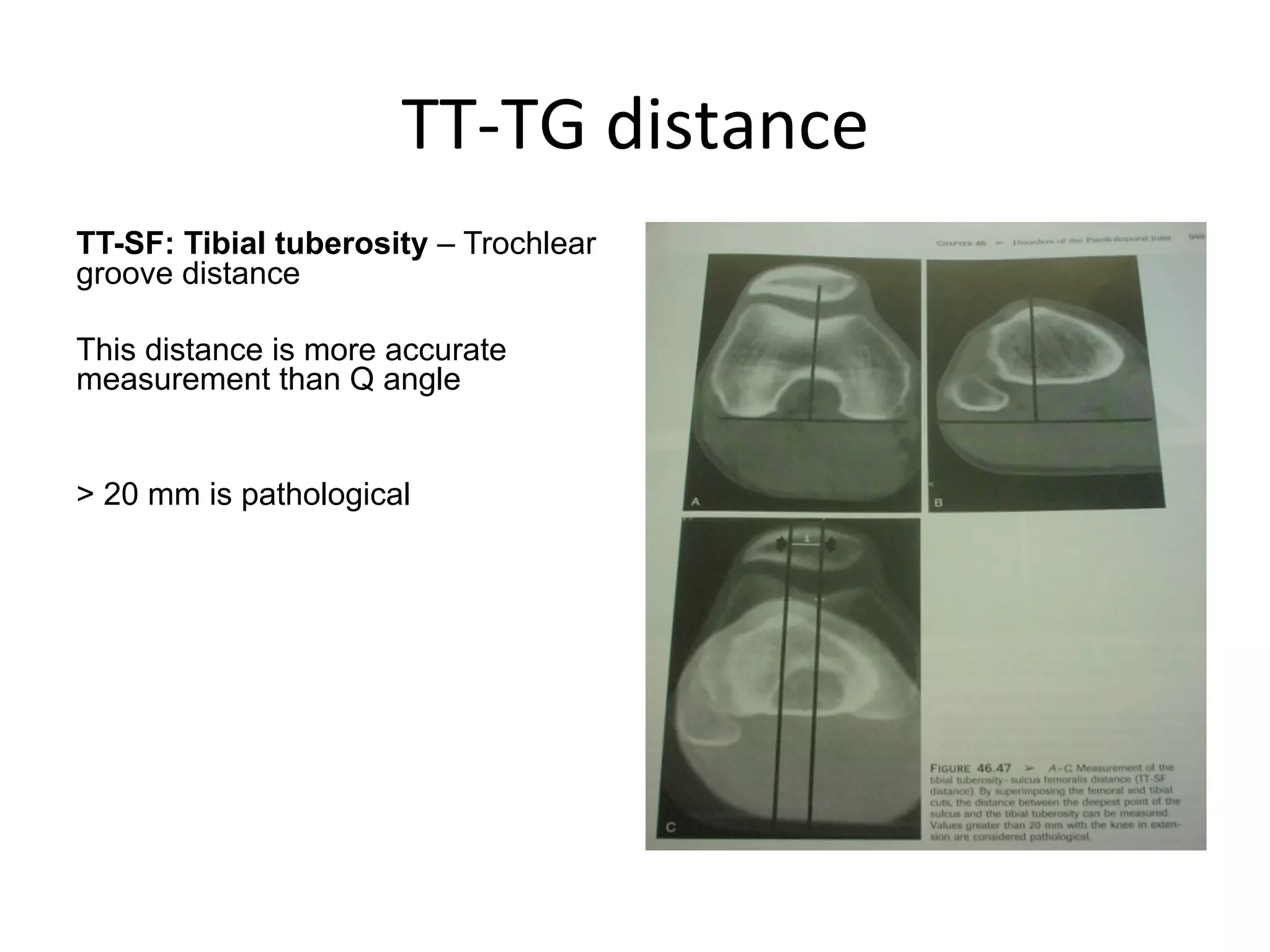 Patellar SKYLINE view.pdf