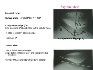 Patellar SKYLINE view.pdf