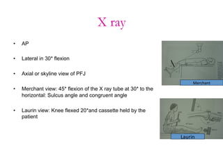 Patellar SKYLINE view.pdf