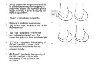 Patellar SKYLINE view.pdf