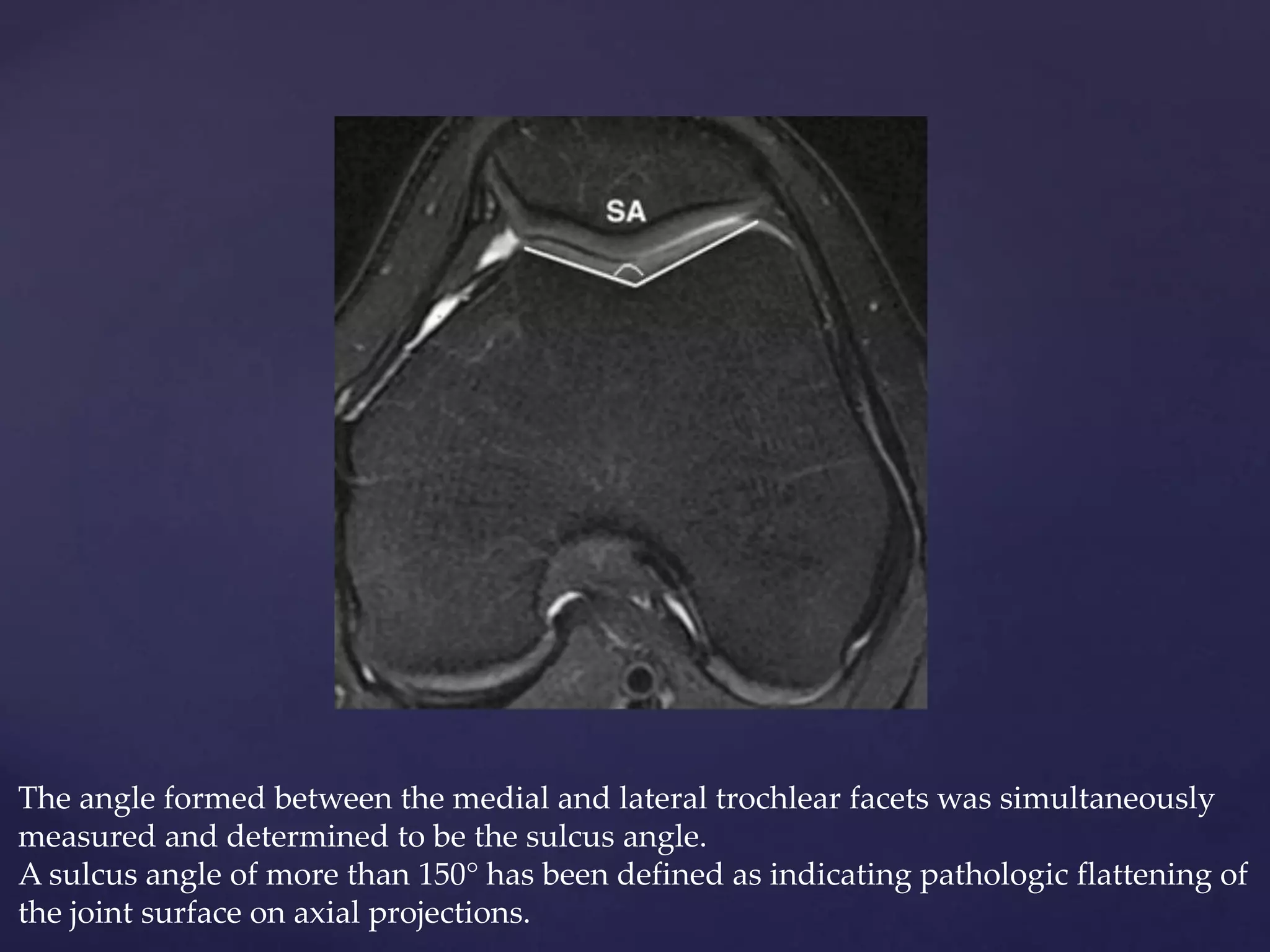 Patello femoral jt. | PPTX