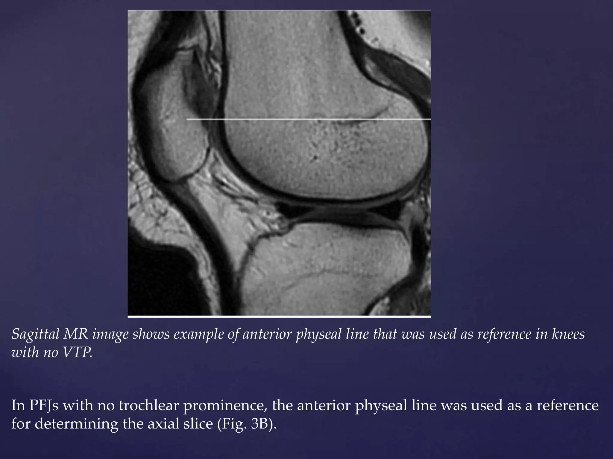 Patello femoral jt. | PPTX