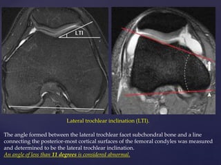 Patello femoral jt. | PPTX