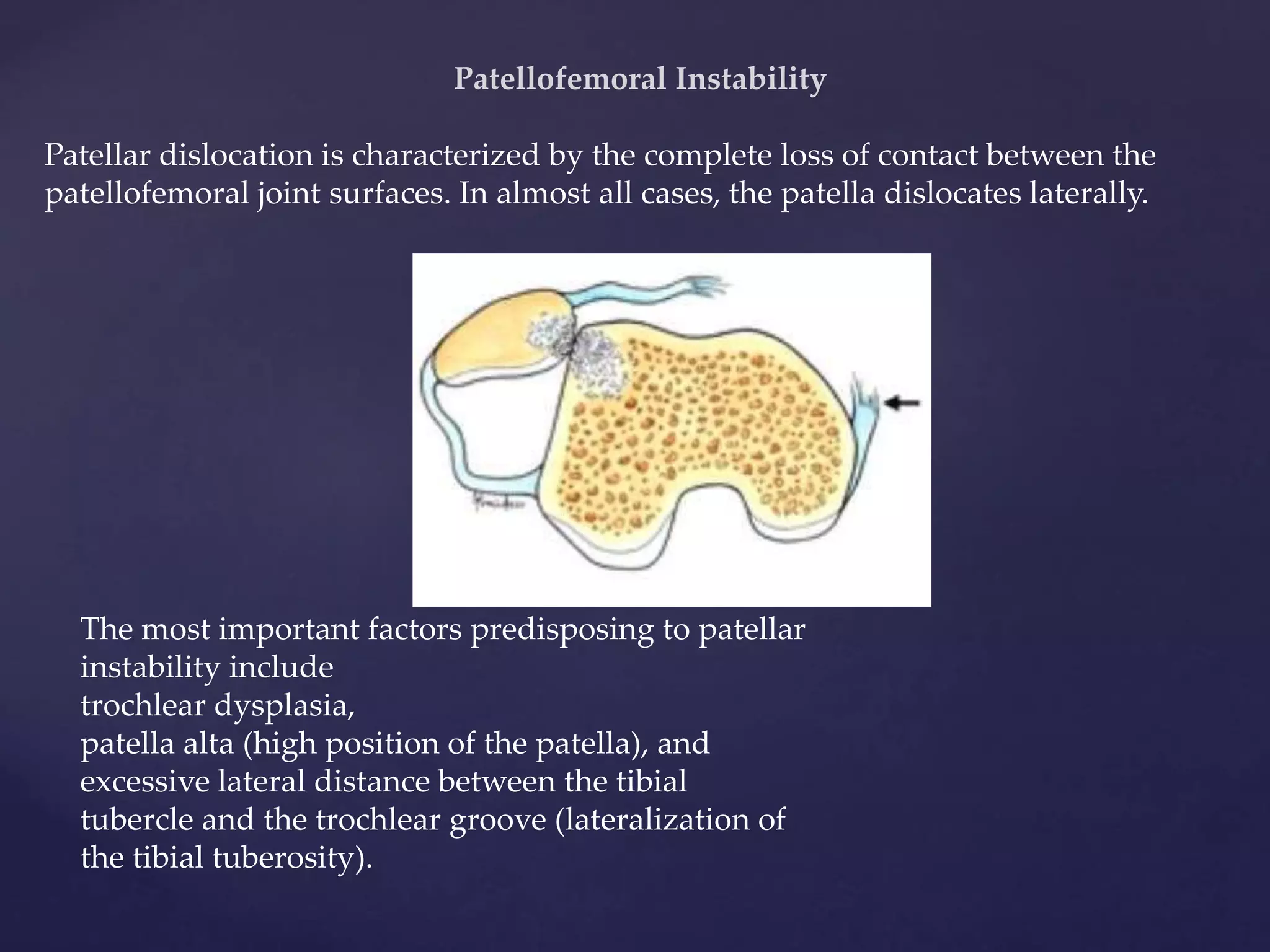 Patello femoral joint - MRI | PPTX