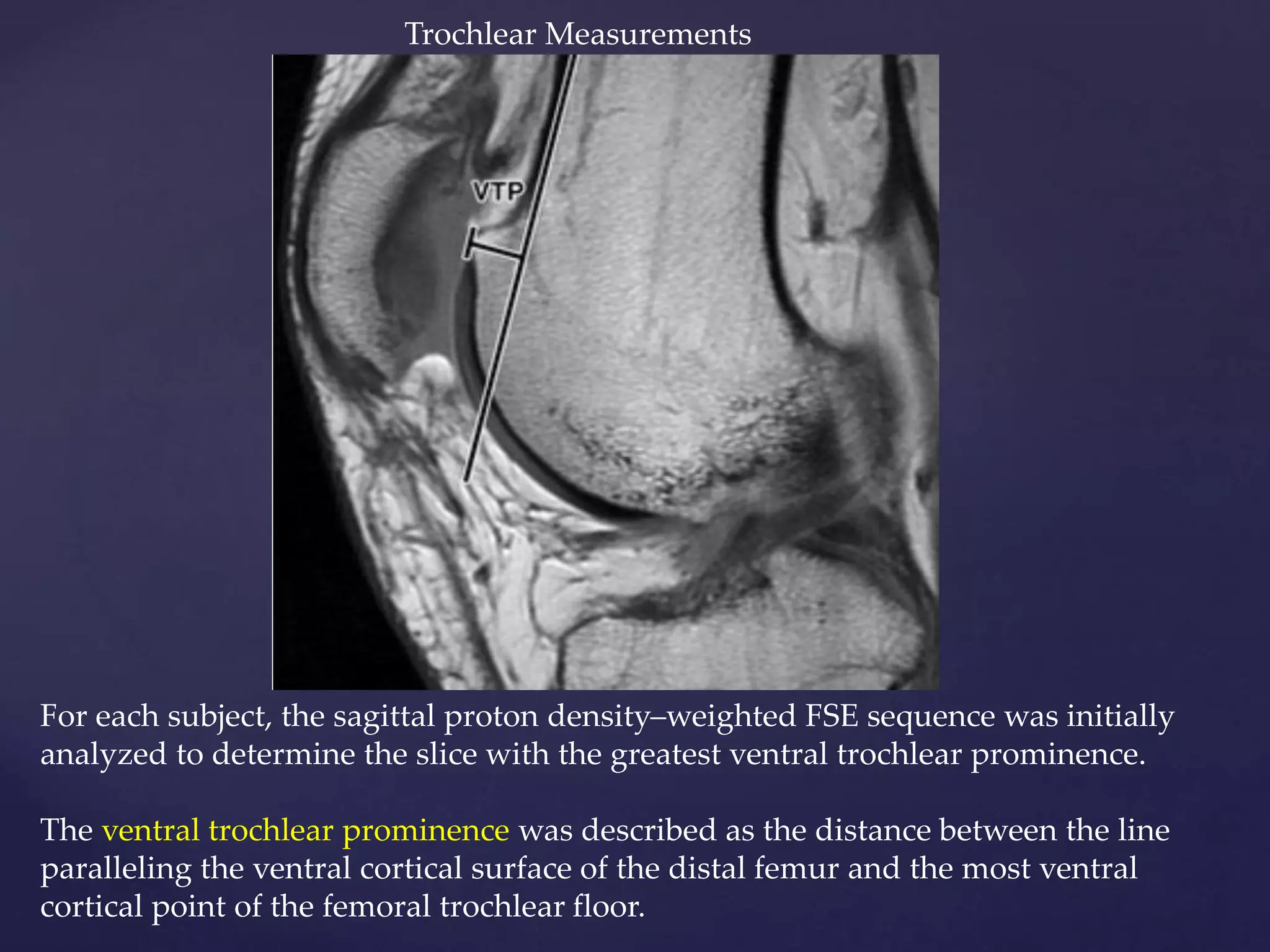 Patello femoral joint - MRI | PPTX