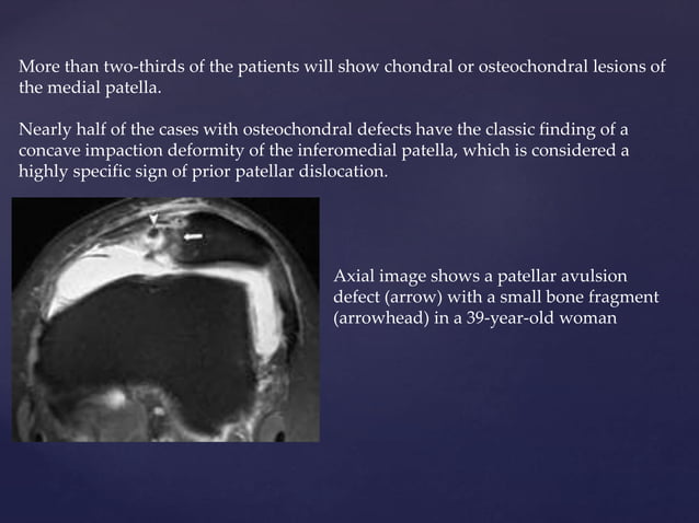 Patello femoral joint - MRI | PPTX