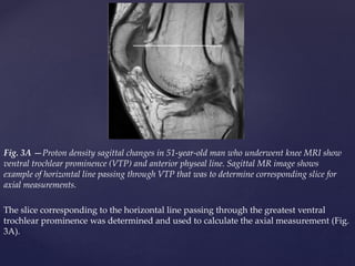 Patello femoral joint - MRI | PPTX