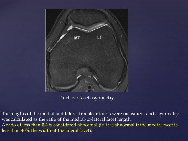 Patello femoral joint - MRI