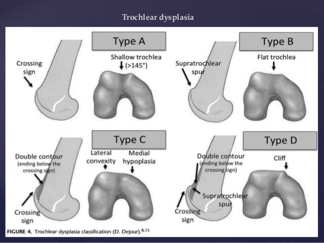 Patello femoral joint - MRI