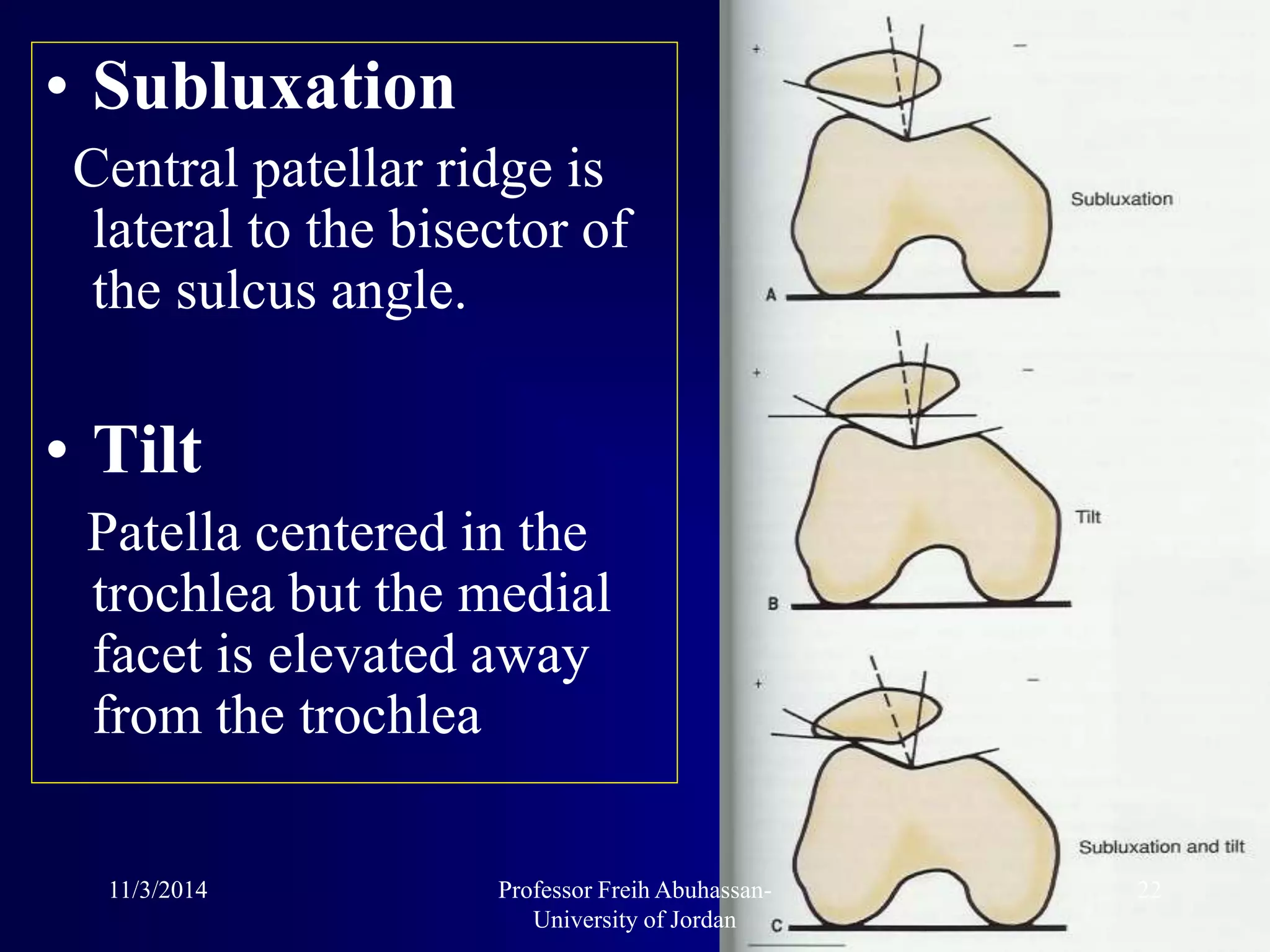 Patellofemoral disease | PPT