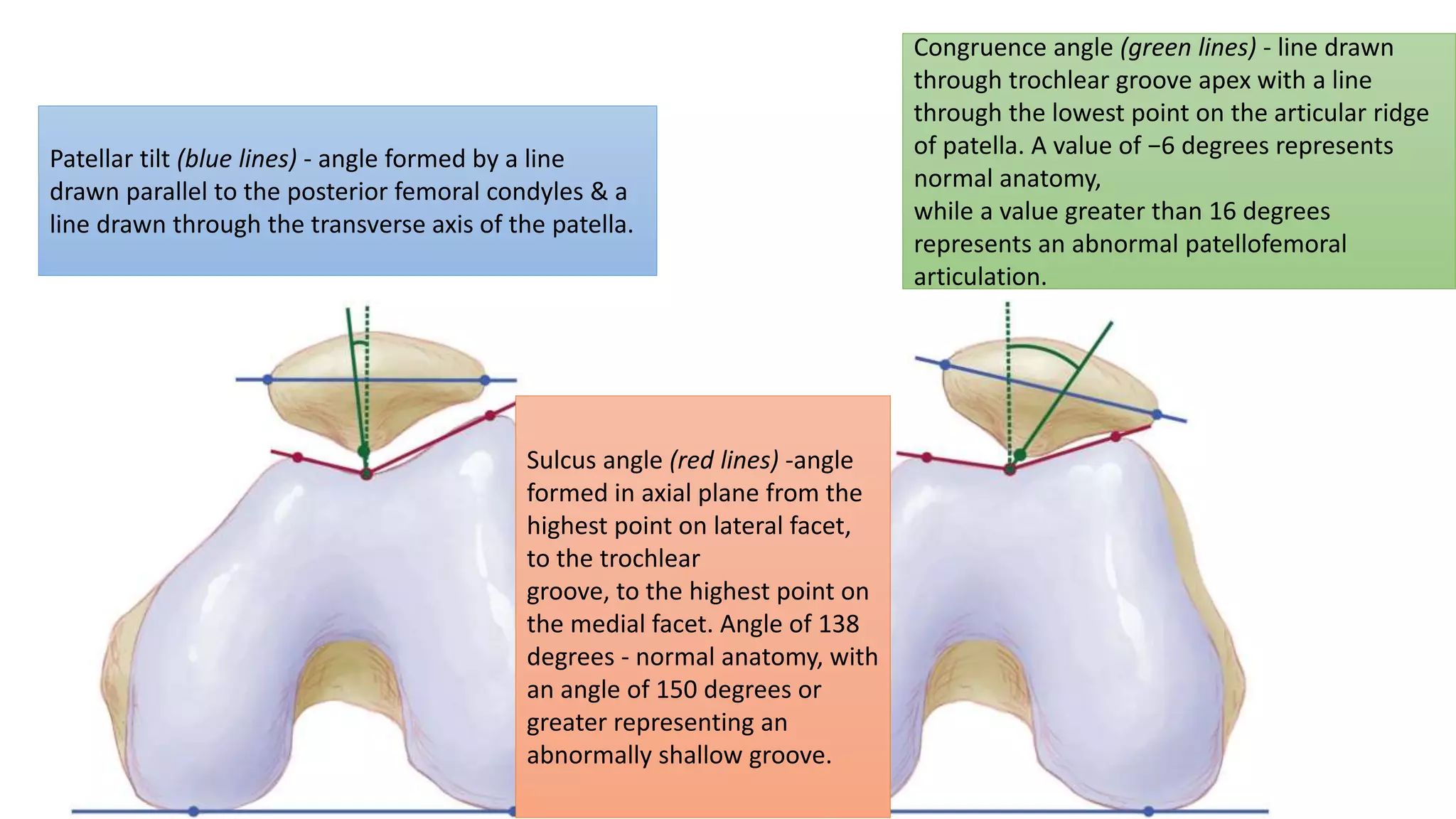 Patellofemoral disorders | PPTX