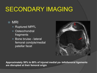 Patellofemoral instability | PPTX