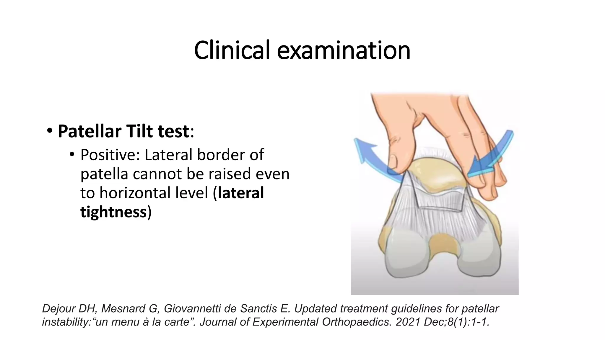 patellofemoral instability.pptx